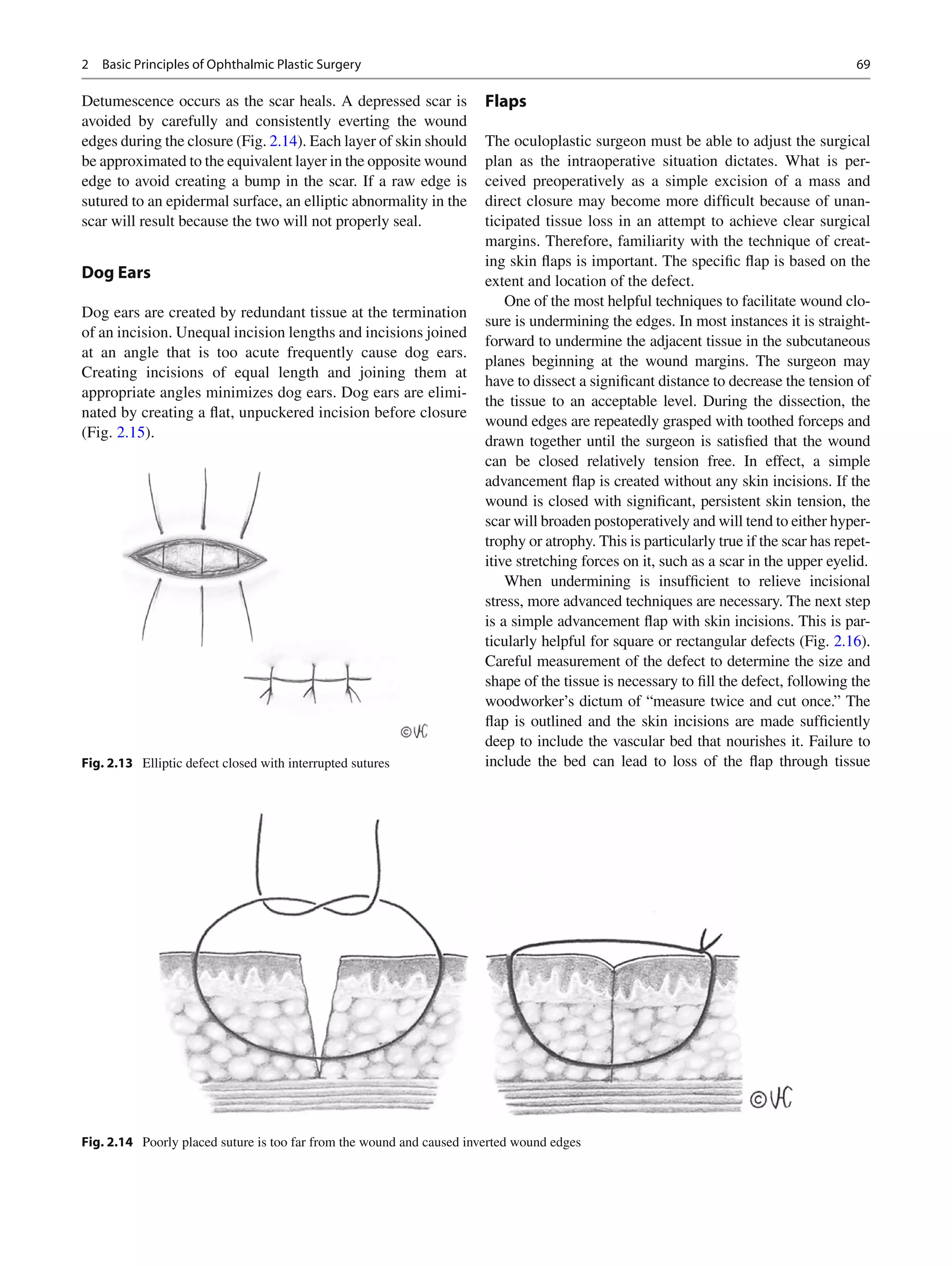 Smith and nesis ophthalmic plastic and reconstructive surgery | PDF
