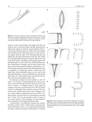 Smith and nesis ophthalmic plastic and reconstructive surgery | PDF