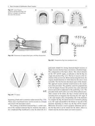 Smith and nesis ophthalmic plastic and reconstructive surgery | PDF