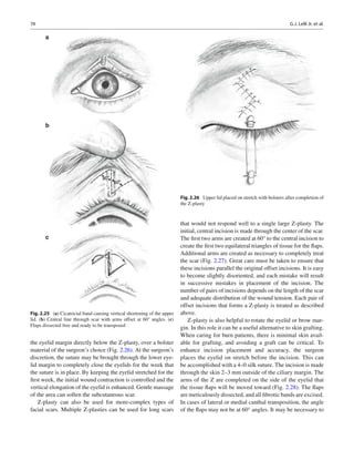 Smith and nesis ophthalmic plastic and reconstructive surgery | PDF