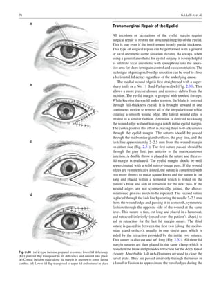 Smith and nesis ophthalmic plastic and reconstructive surgery | PDF