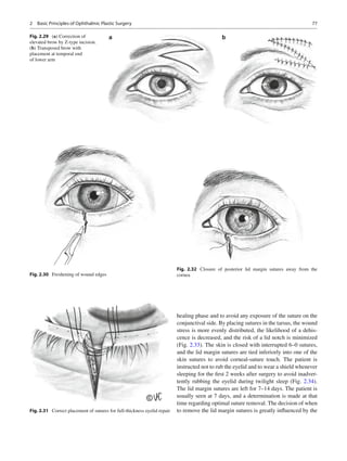 Smith and nesis ophthalmic plastic and reconstructive surgery | PDF
