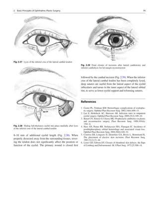 Smith and nesis ophthalmic plastic and reconstructive surgery | PDF