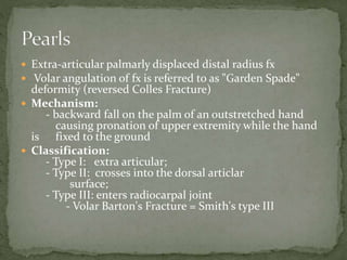 Smith’s fracture Power Point | PPTX
