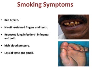 Smoking.pptx