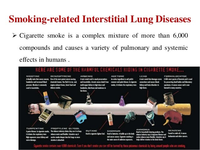 Smoking related interstitial lung diseases