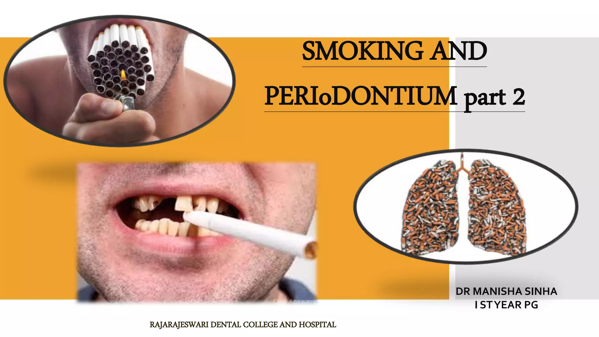 Smoking and peridontium part 2 | PPTX