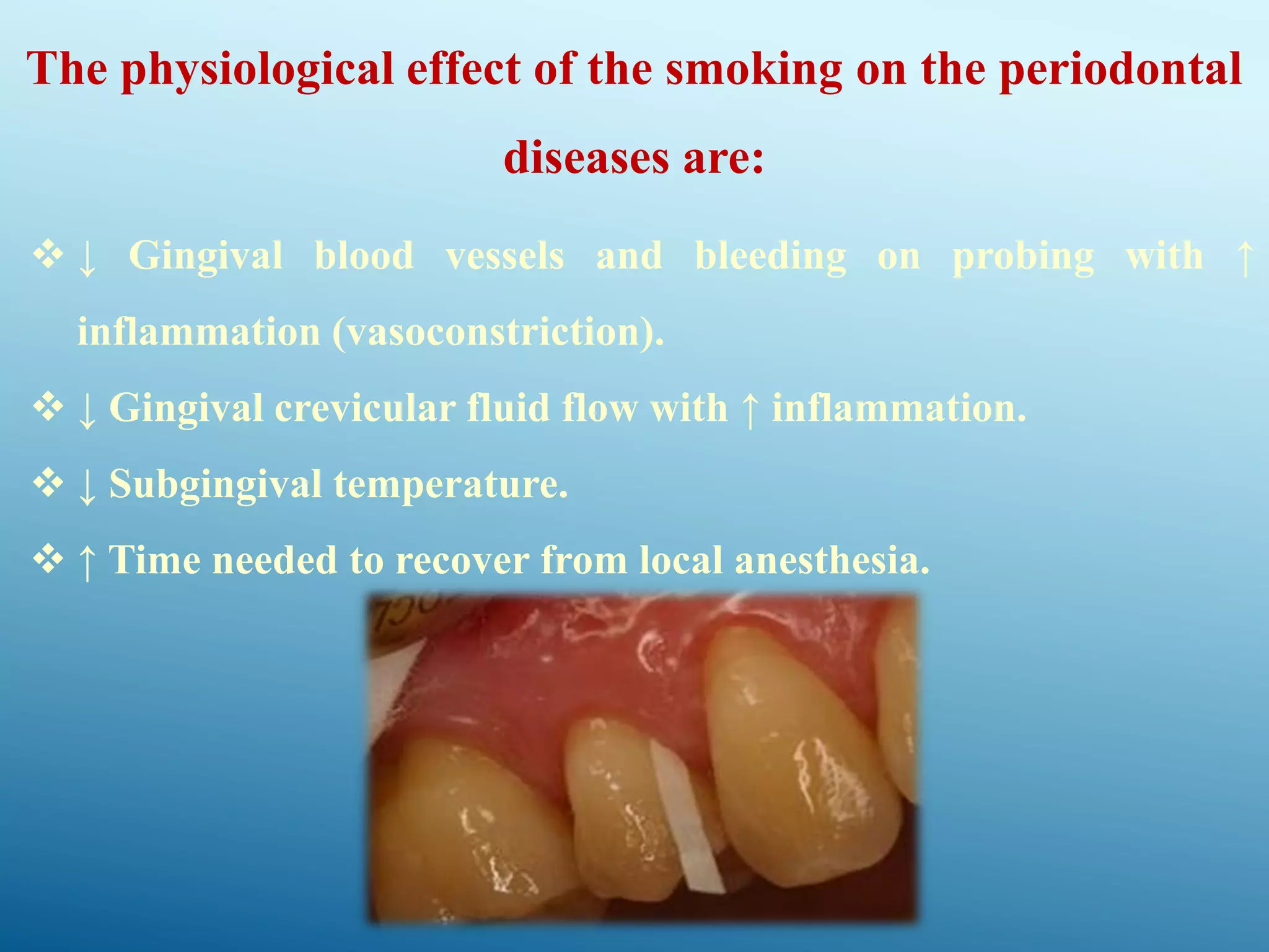 Smoking and periodontal disease | PDF