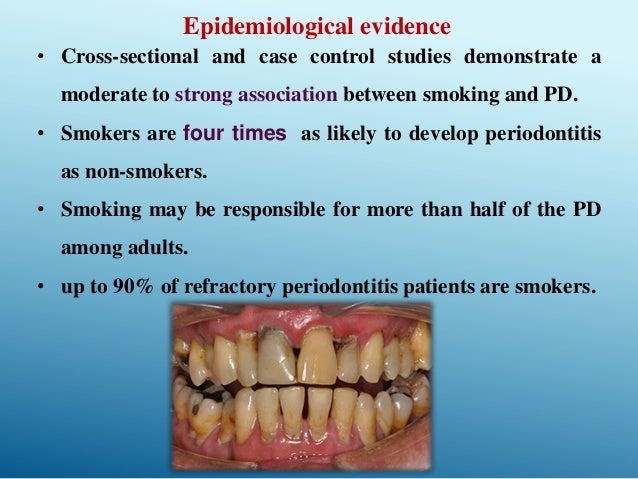 Smoking and periodontal disease Smoking and periodontal disease