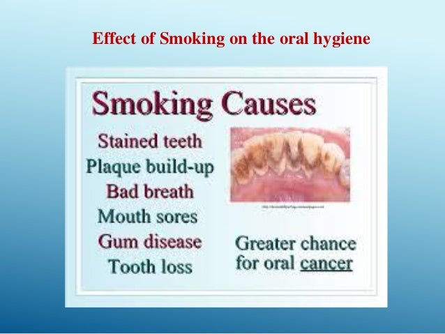Smoking and periodontal disease Smoking and periodontal disease