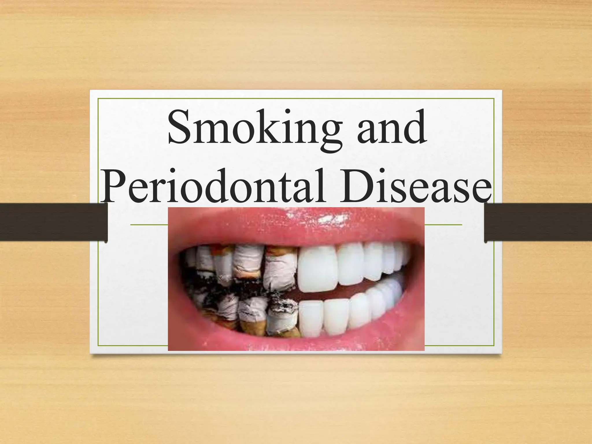 Smoking and Periodontal Disease presentation | PPTX