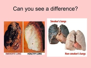 Smoking and your lungs | PPT