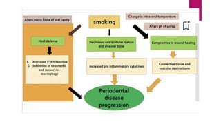 Smoking as Risk Factor For Periodontal Disease.pptx