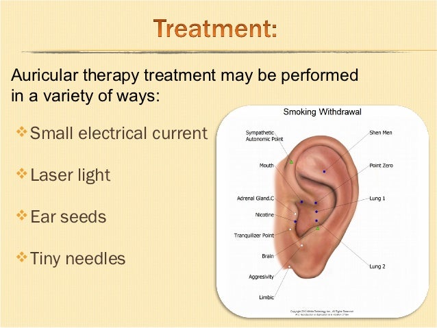 Smoking Cessation, Synergy Chiropractic Springboro, OH