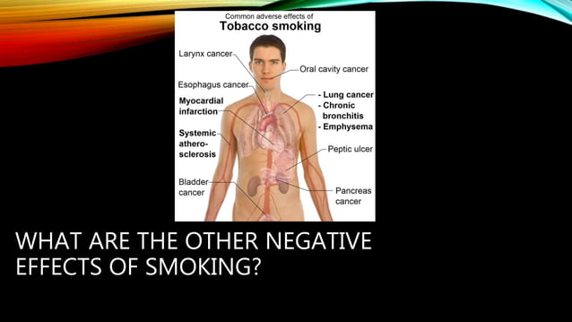 Smoking is dangerous for health | PPTX