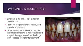 Smoking_PERIO .pptx