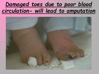 smoking ppt.ppt