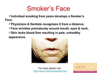 Smoking & Your Teeth | PPT | Dental Health | Diseases and Conditions