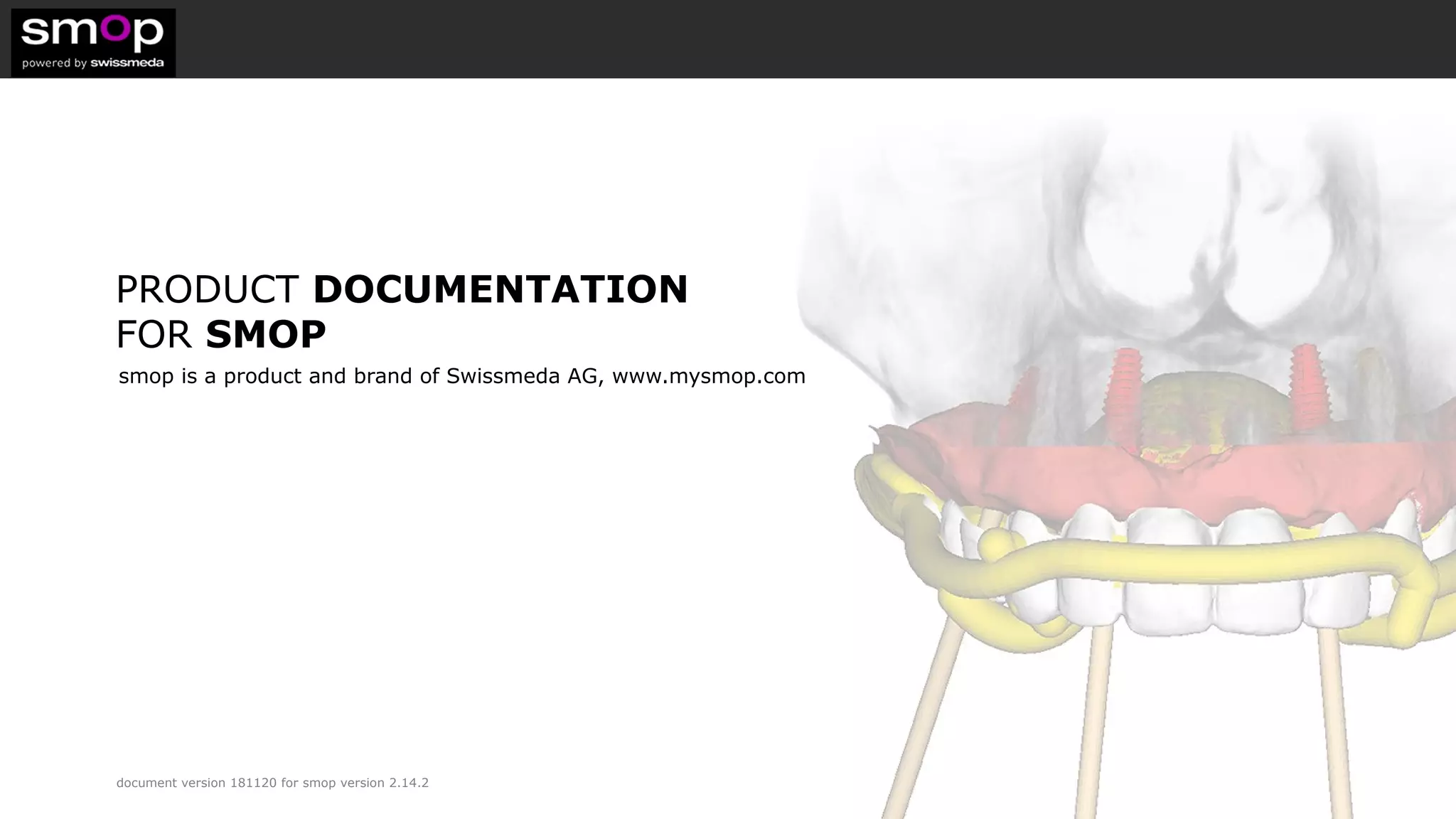SMoP Guided Surgery Solution | PPT