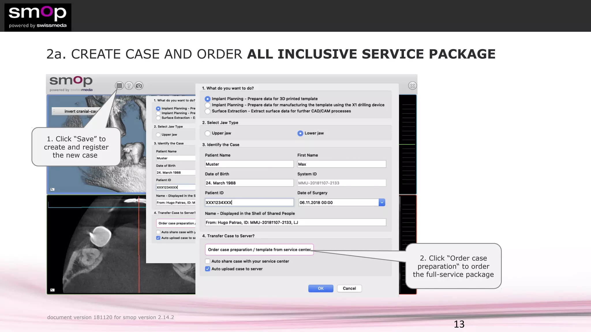 SMoP Guided Surgery Solution | PPT