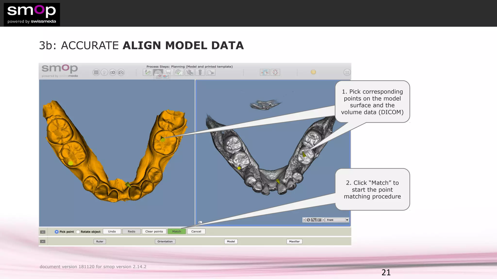 SMoP Guided Surgery Solution | PPT
