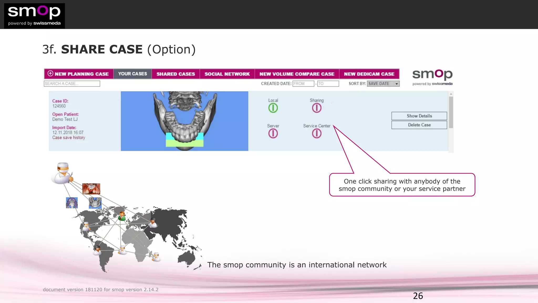 SMoP Guided Surgery Solution | PPT