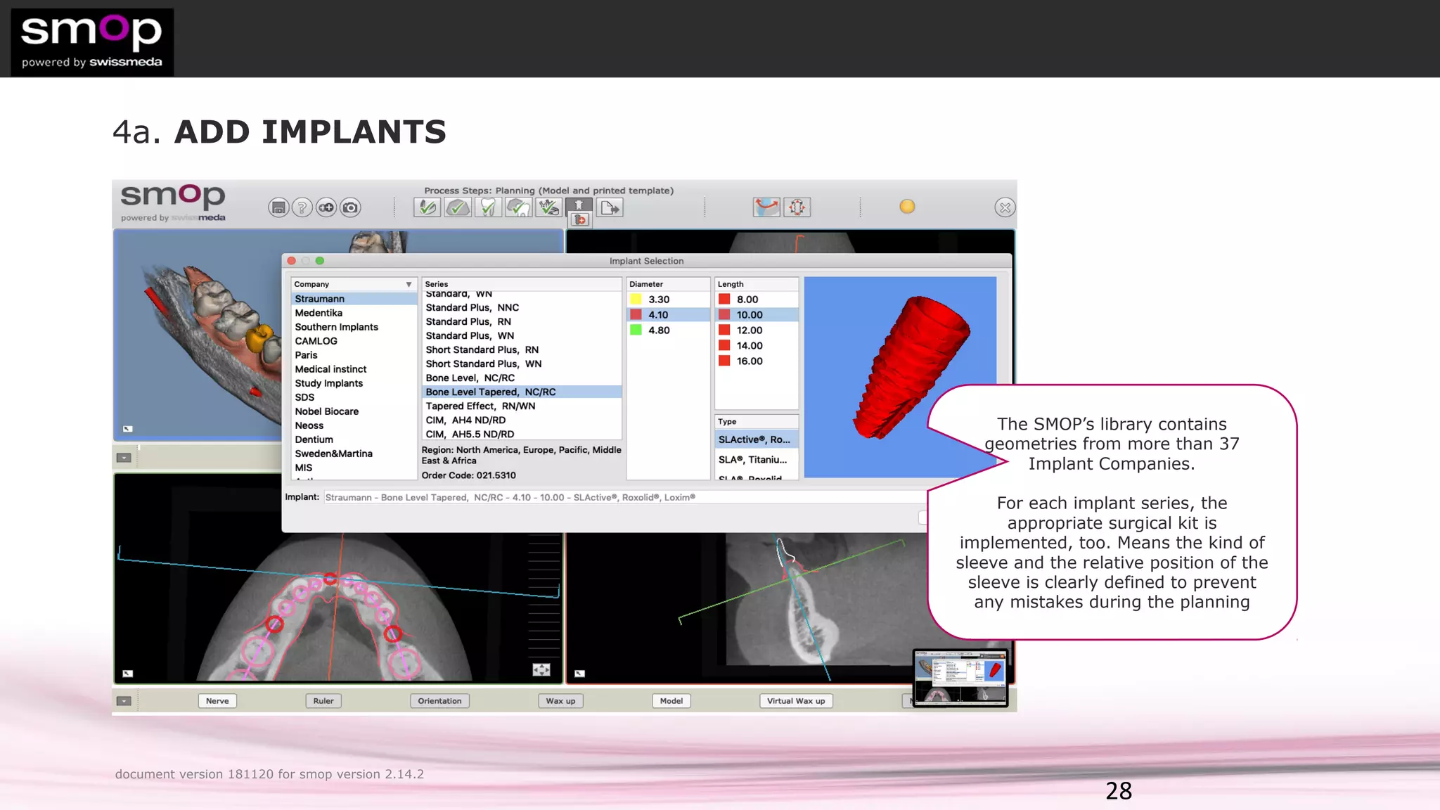 SMoP Guided Surgery Solution | PPT
