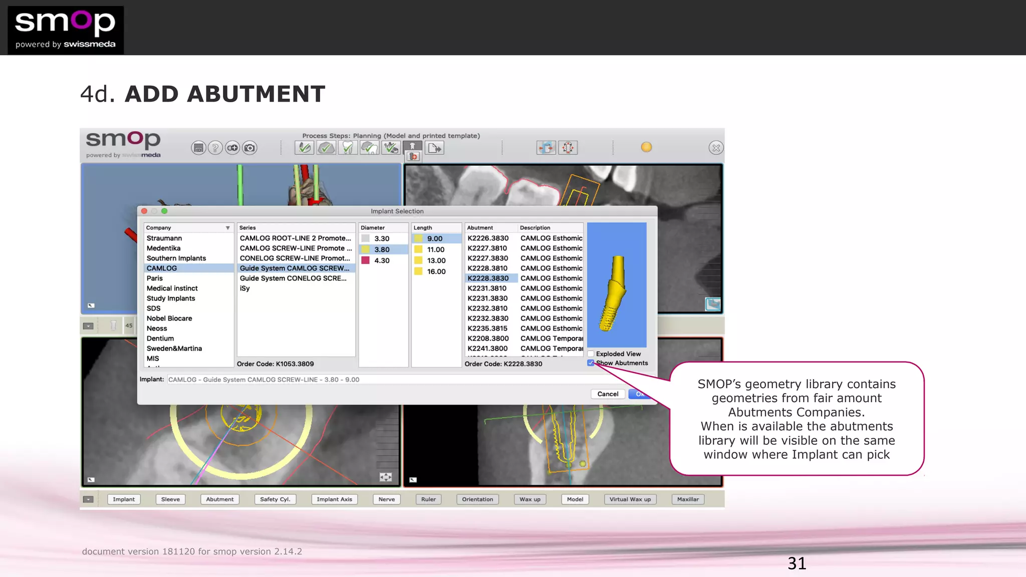SMoP Guided Surgery Solution | PPT