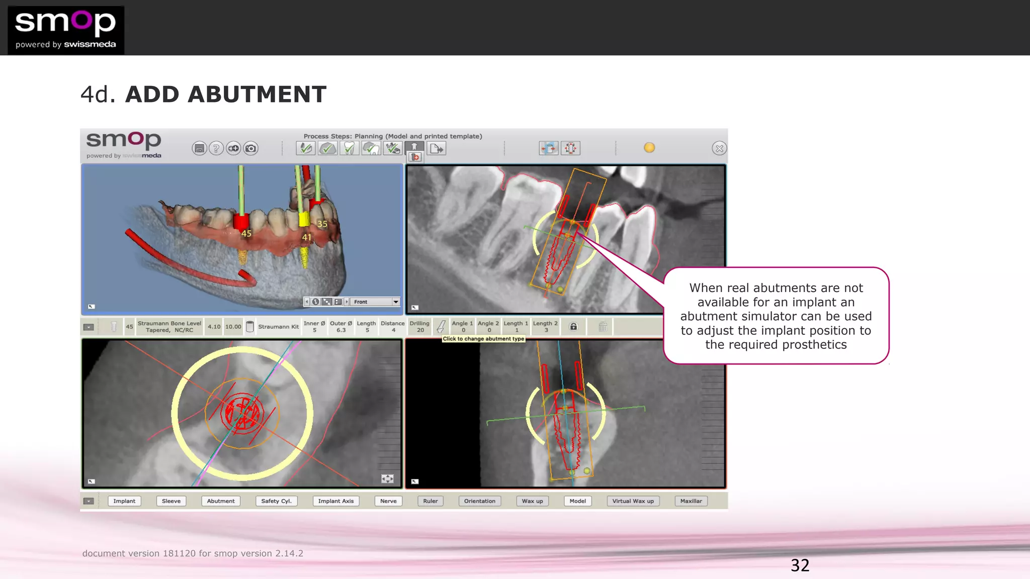 SMoP Guided Surgery Solution | PPT