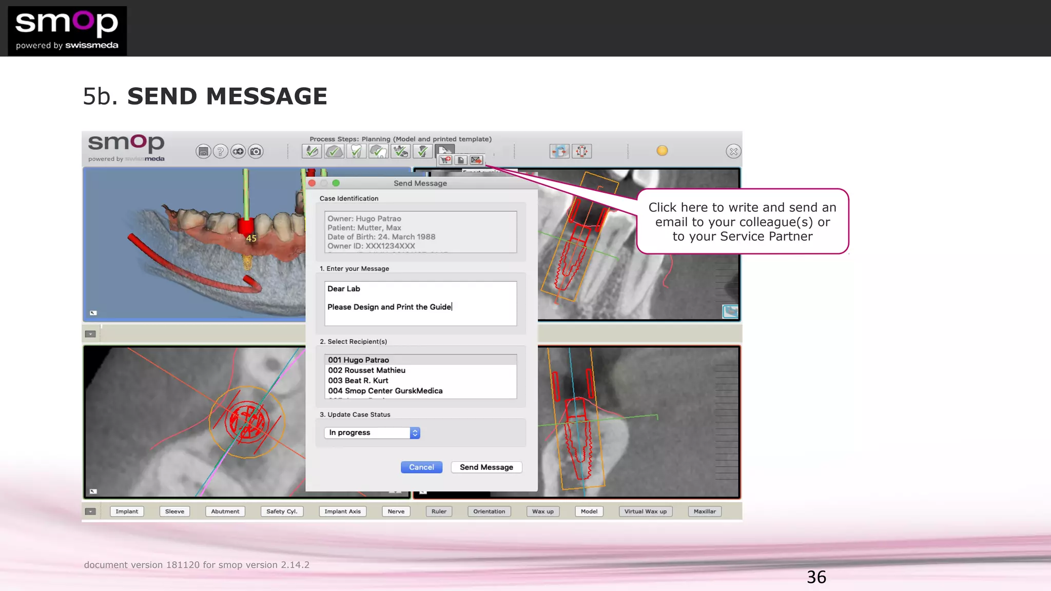 SMoP Guided Surgery Solution | PPT
