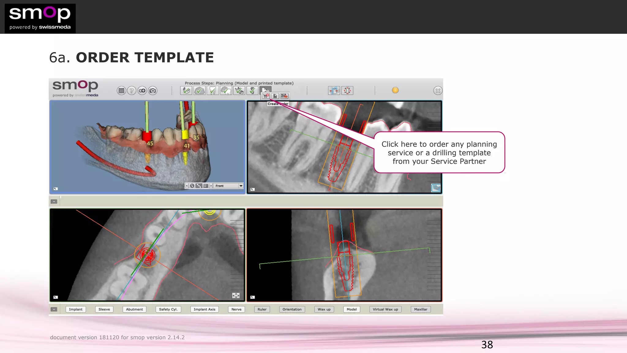 SMoP Guided Surgery Solution | PPT