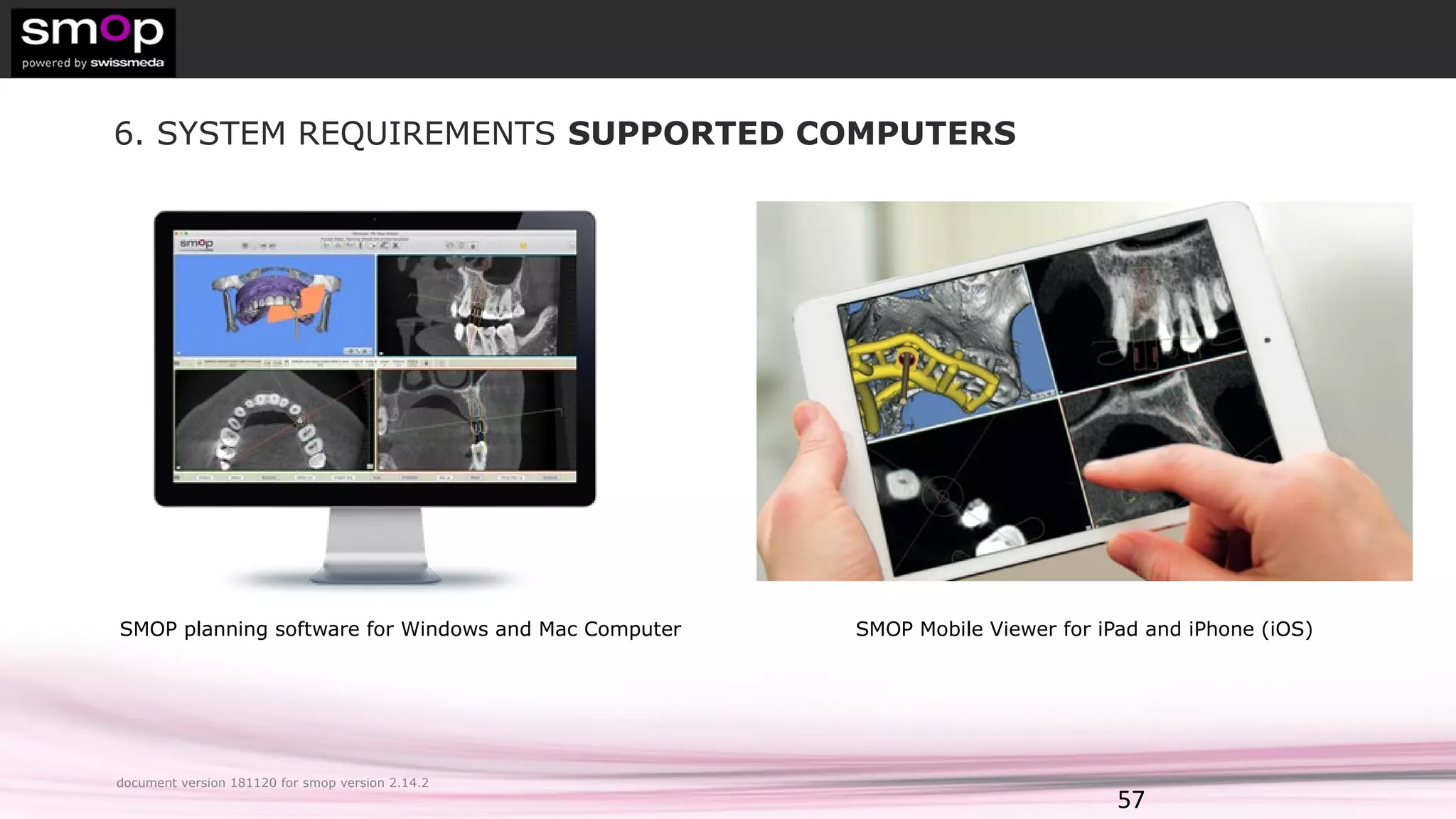 SMoP Guided Surgery Solution | PPT