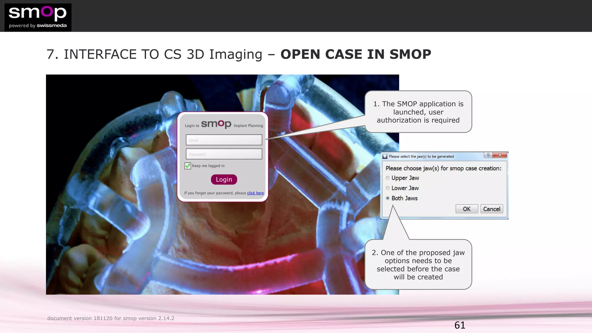 SMoP Guided Surgery Solution | PPT