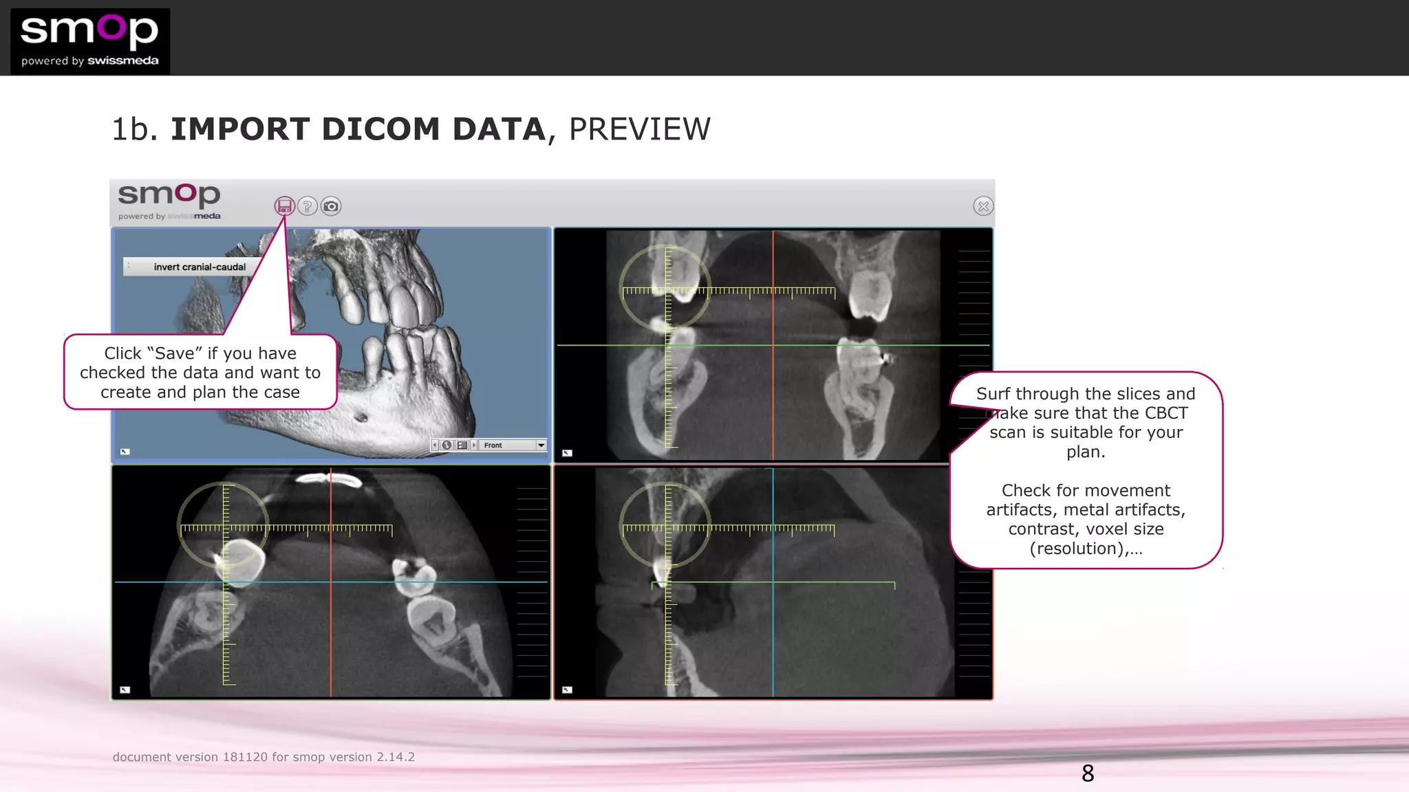 SMoP Guided Surgery Solution | PPT