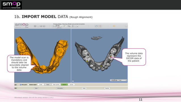 SMoP Guided Surgery Solution | PPT