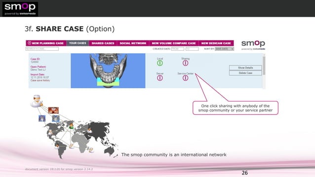 SMoP Guided Surgery Solution | PPT