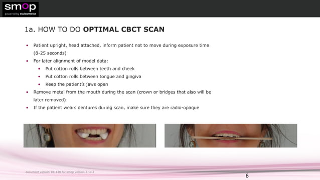 SMoP Guided Surgery Solution | PPT