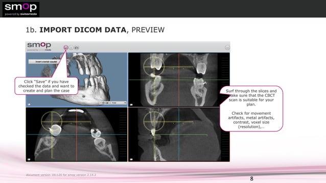 SMoP Guided Surgery Solution | PPT