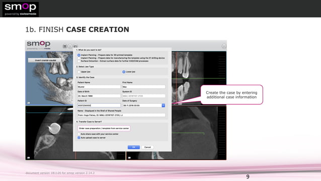 SMoP Guided Surgery Solution | PPT