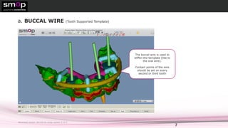 SMoP Guide Design Instructions | PPT