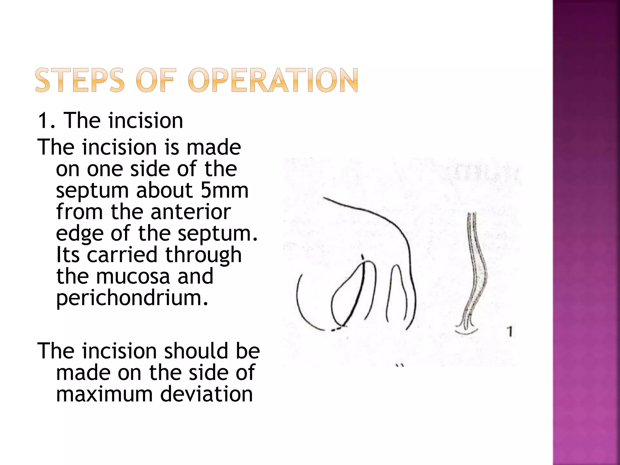 Smr and septoplasty | PPTX