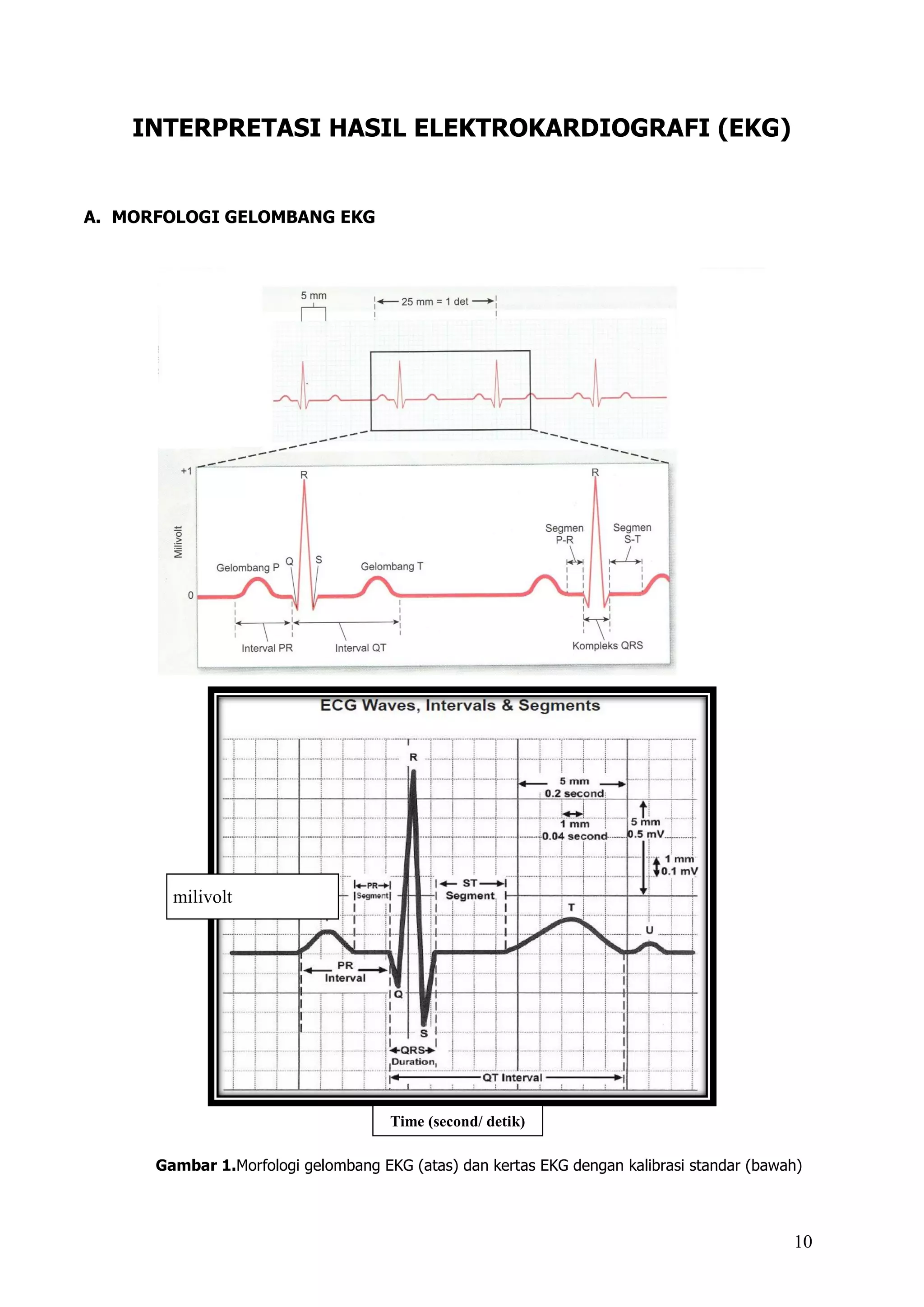 smt-4-Interpretasi-EKG.pdf