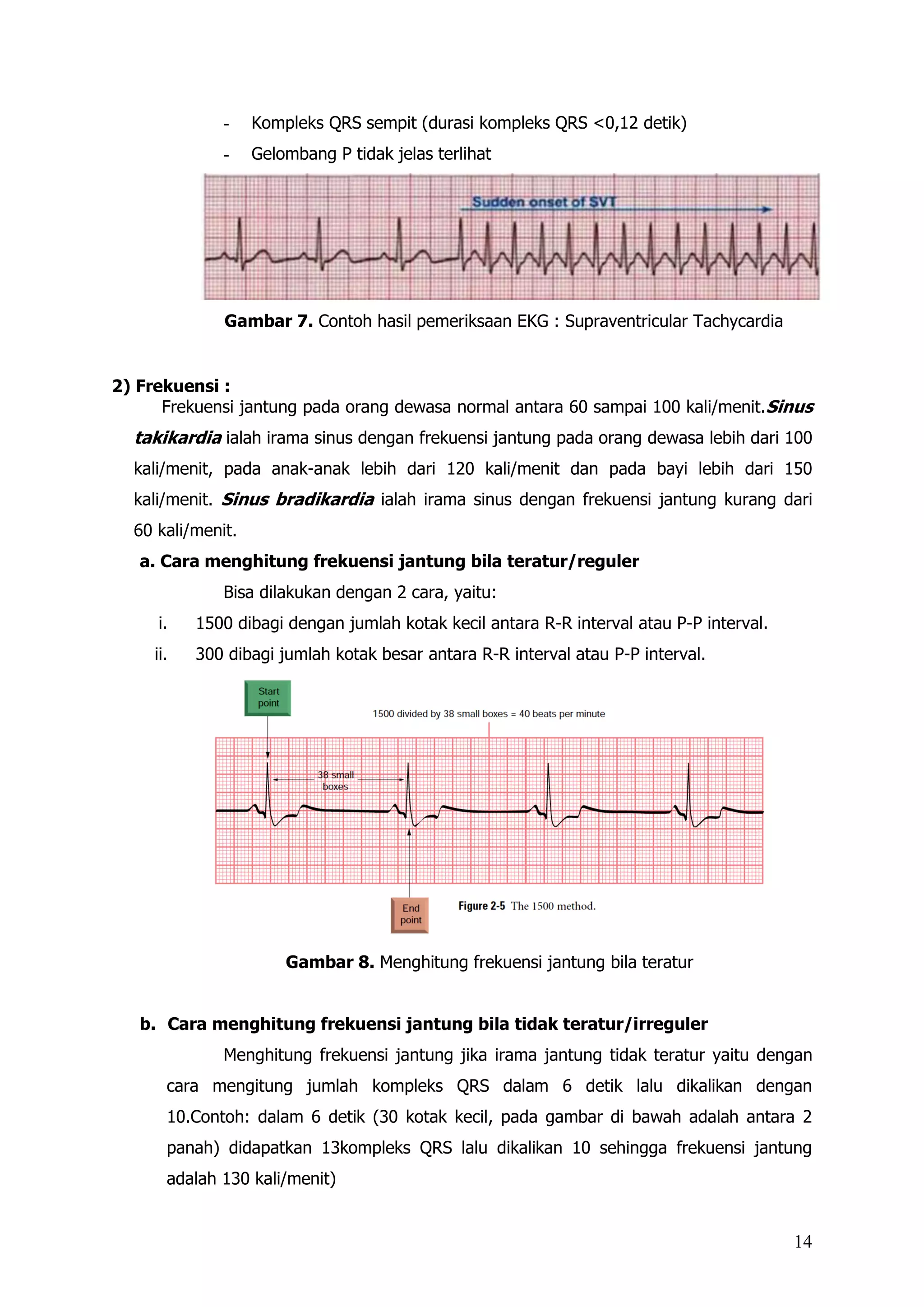 smt-4-Interpretasi-EKG.pdf