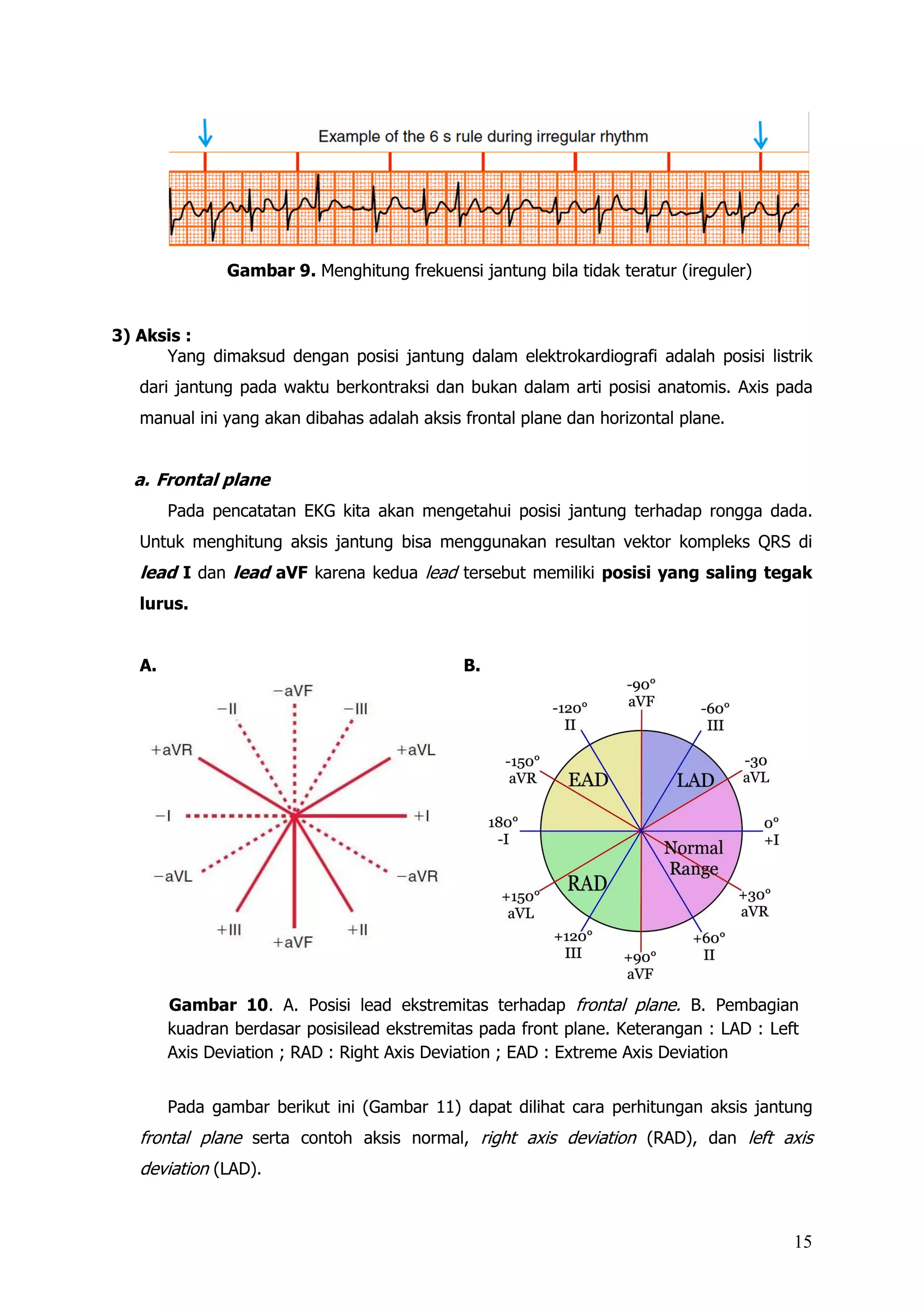 smt-4-Interpretasi-EKG.pdf