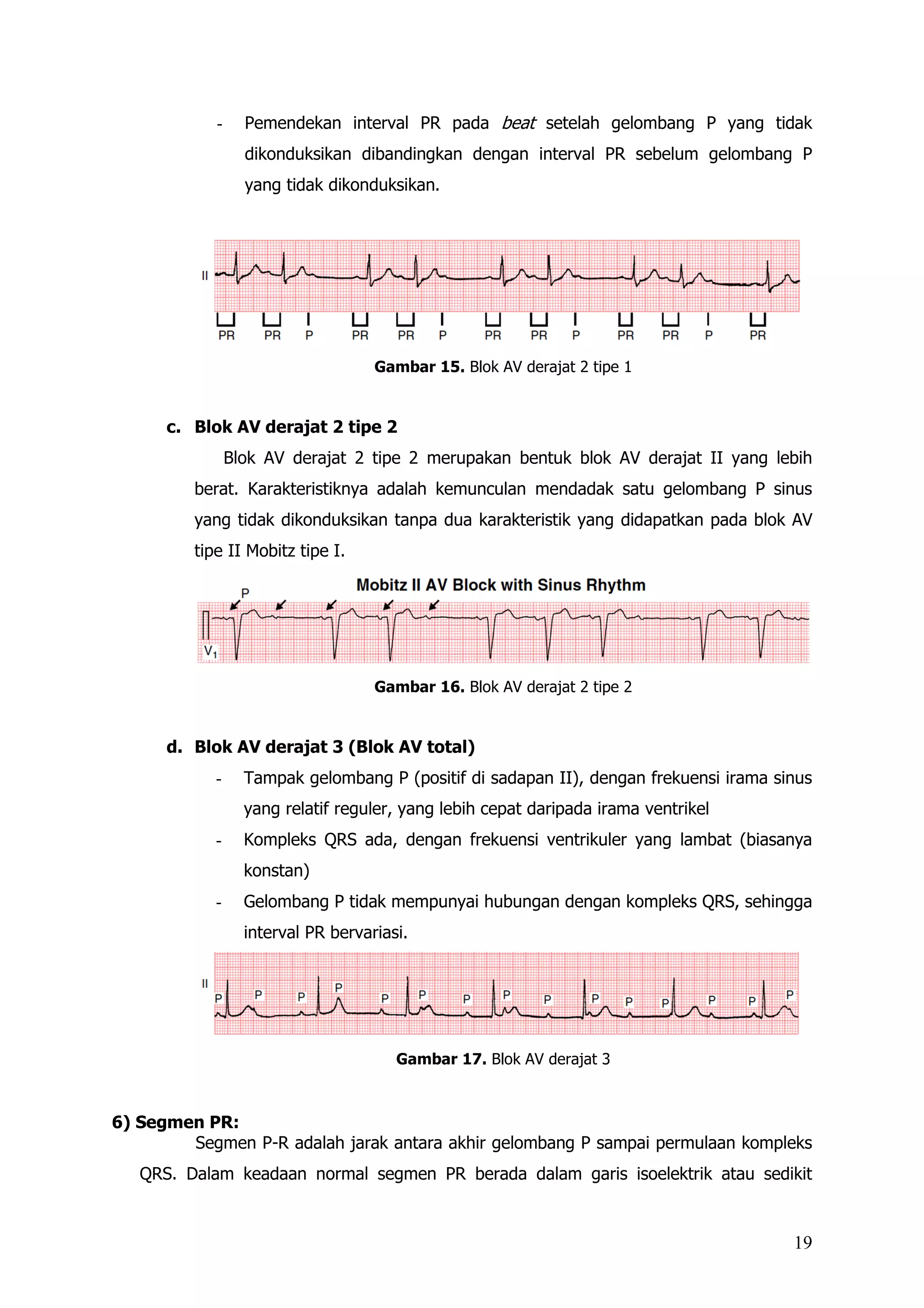 smt-4-Interpretasi-EKG.pdf