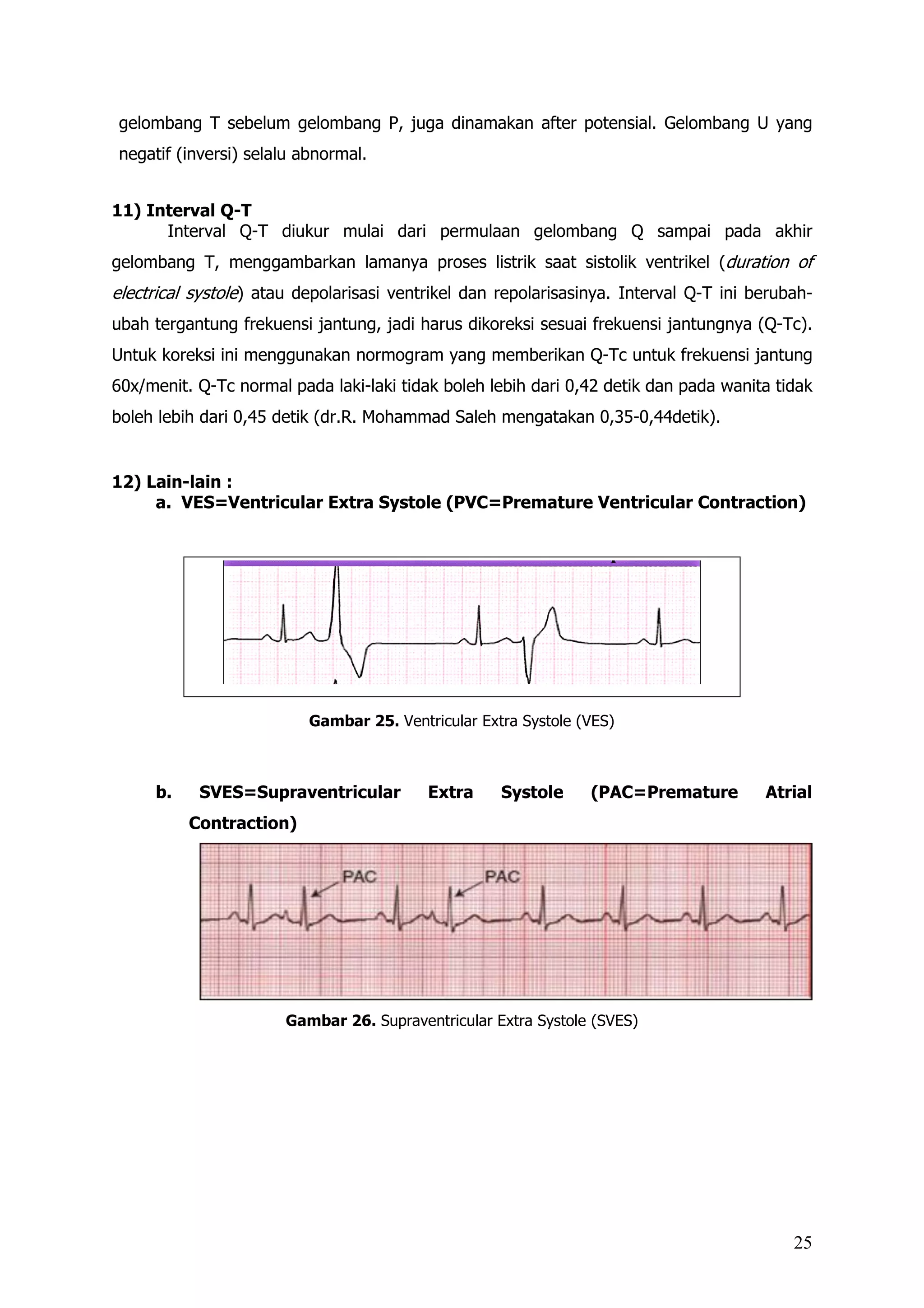 smt-4-Interpretasi-EKG.pdf