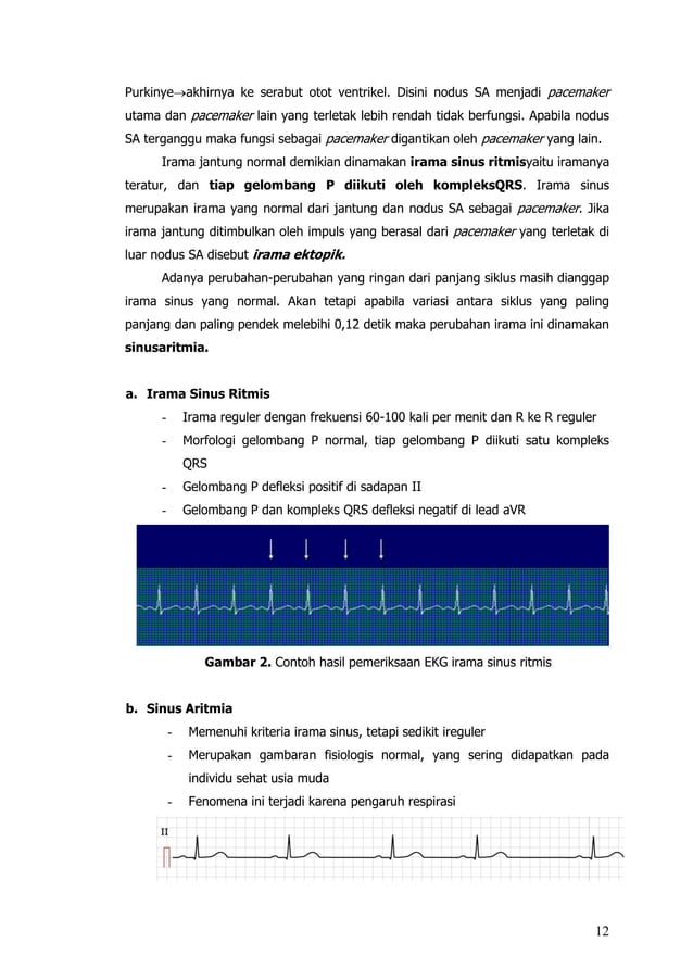 smt-4-Interpretasi-EKG.pdf