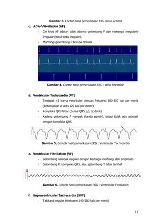 smt-4-Interpretasi-EKG.pdf