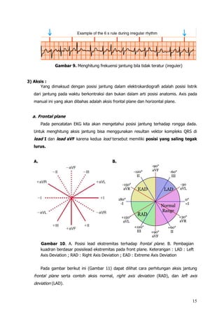 smt-4-Interpretasi-EKG.pdf