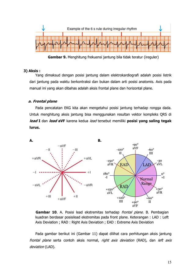 smt-4-Interpretasi-EKG.pdf